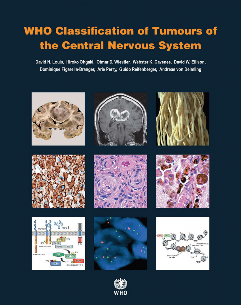 New WHO Classification of CNS Tumors – Neuropathology Blog